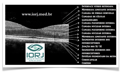 OCT Retina – IORJ